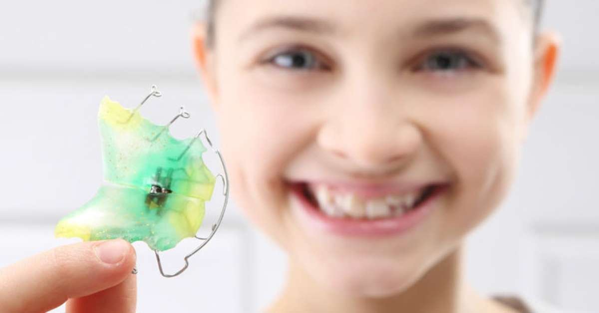 Aparelho Expansor Infantil: Inferior, Superior, Fixo, Móvel e Preço